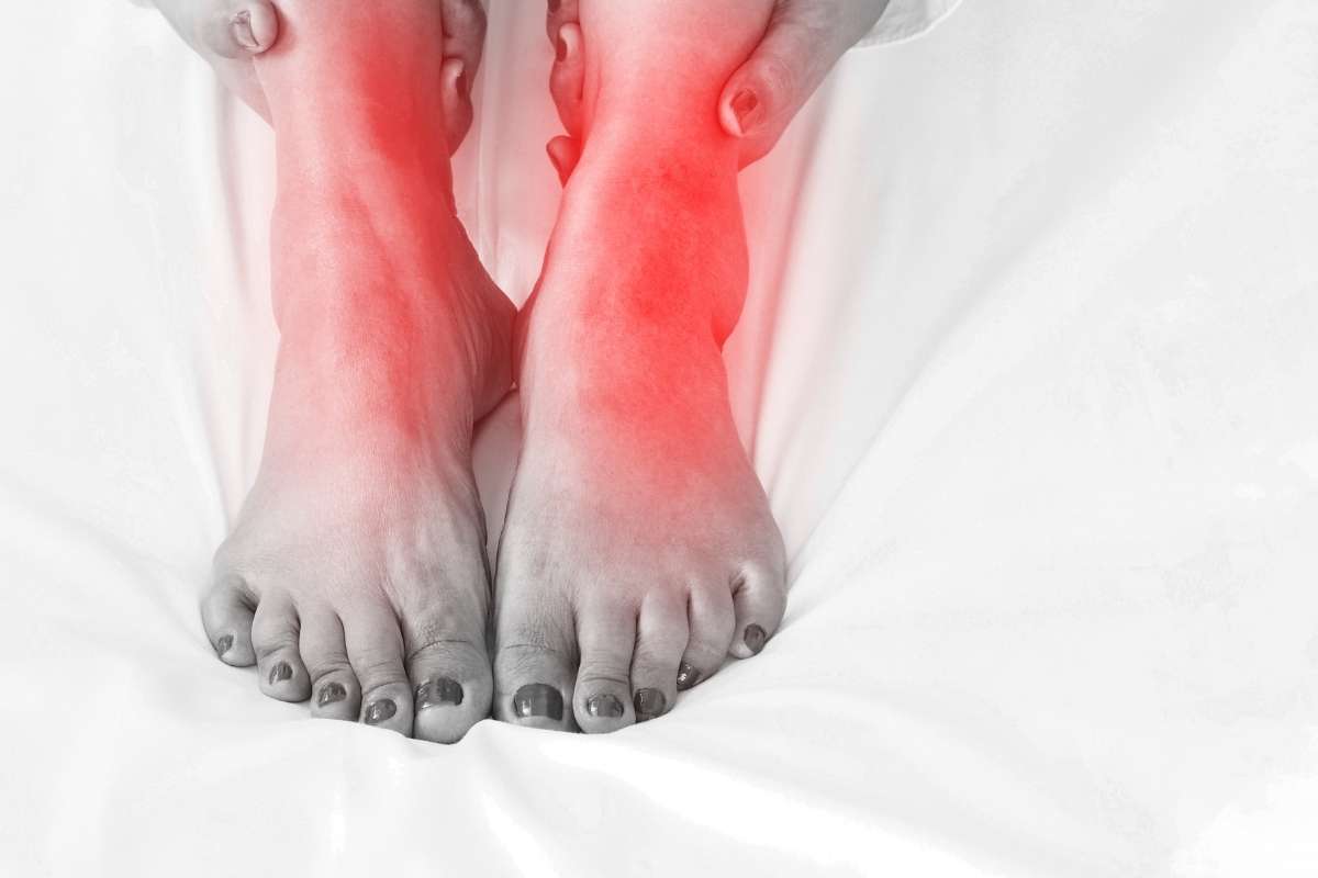 QUAL A DIFERENÇA ENTRE ARTRITE E ARTROSE? – Dr. Fabio Datti ... QUAL A DIFERENÇA ENTRE ARTRITE E ARTROSE? – Dr. Fabio Datti ...